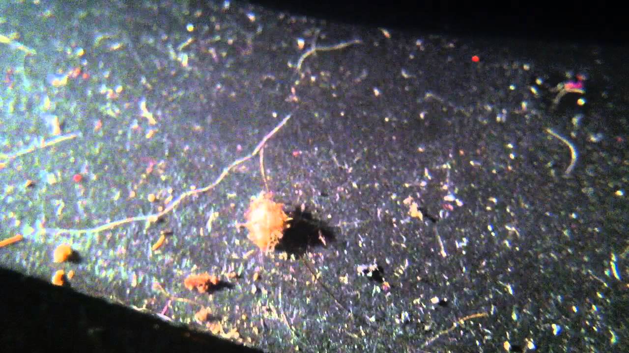 Morgellons weaponized synthetic biology- watch it MOVE-it is ALIVE ...