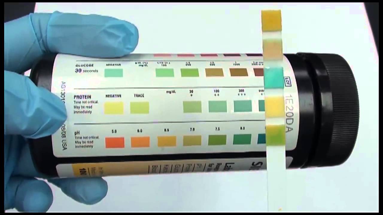 Multistix 10 sg chart - whmaxb