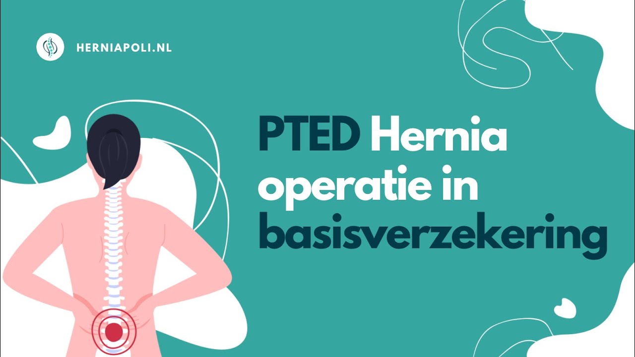Vergoeding PTED Hernia operatie - Herniapoli - YouTube