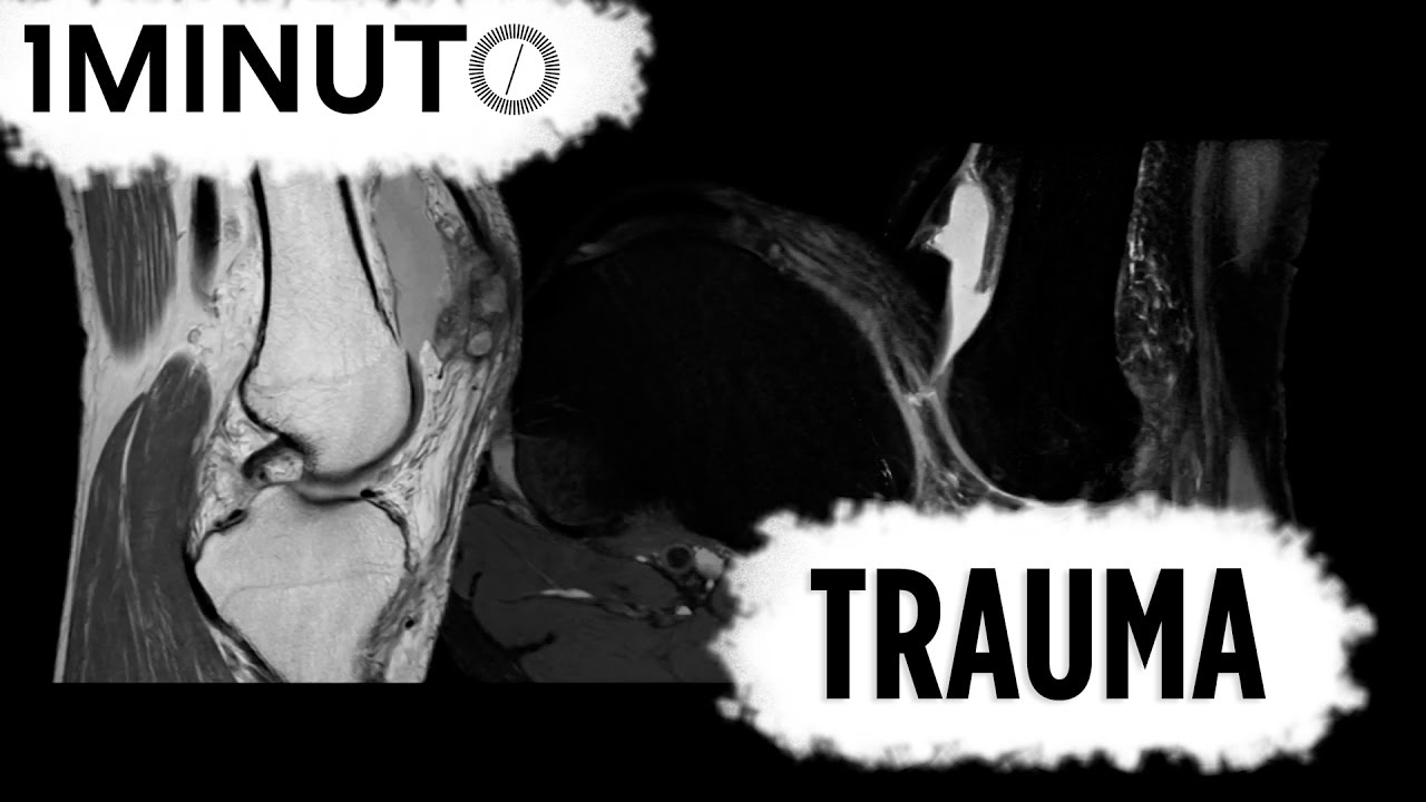 Trauma - Daniel Codina - YouTube