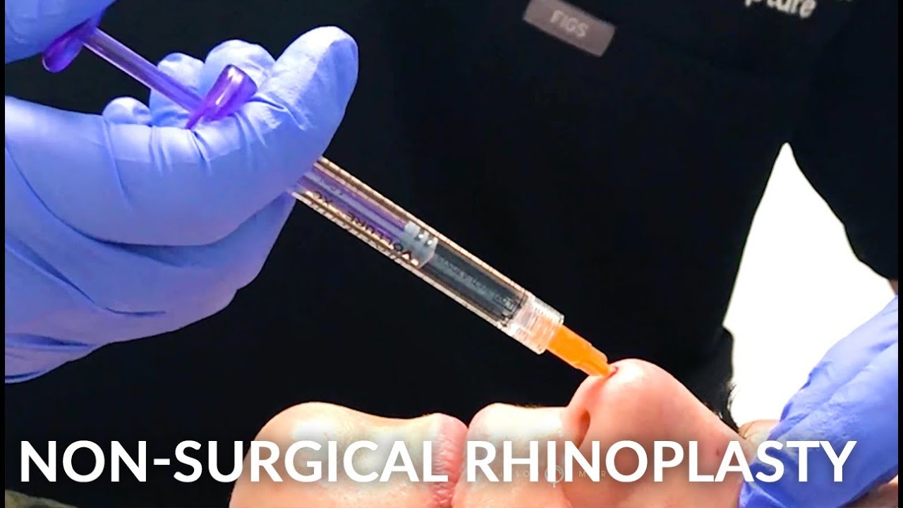 Non-Surgical Nose Job | Rhinoplasty with Filler Injections | Nose Job ...