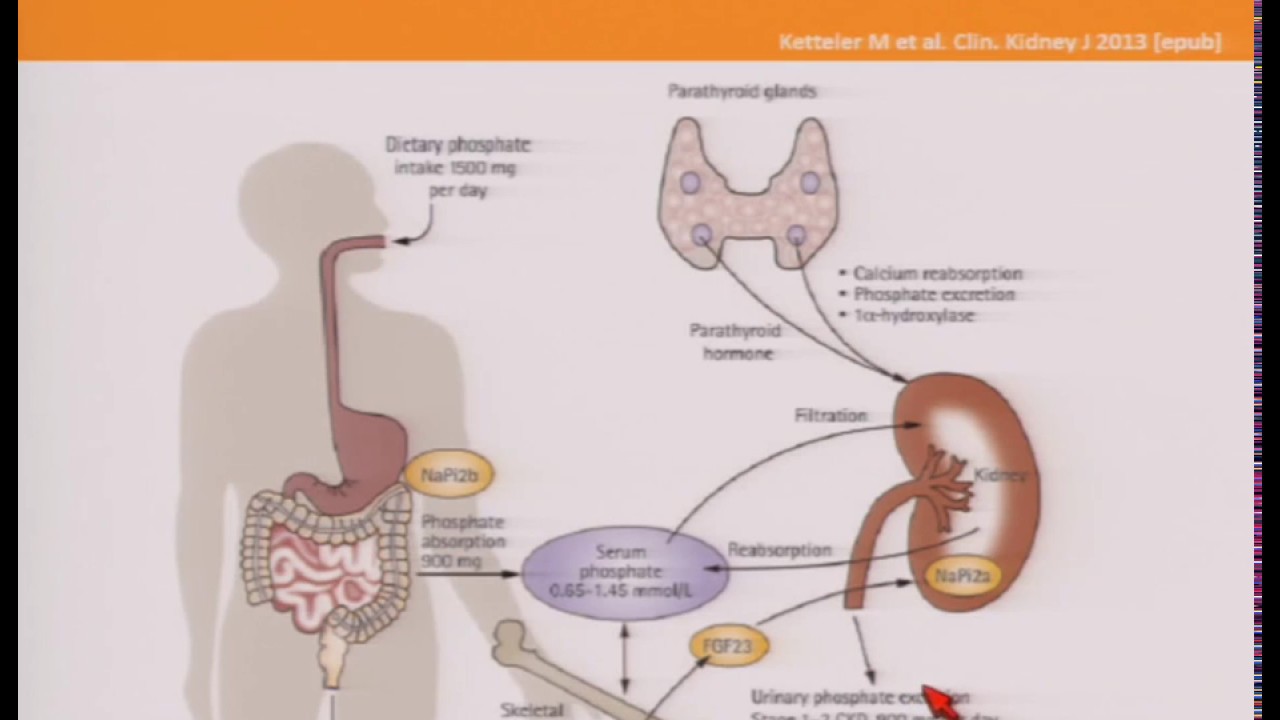 vascular calcification calcium and phosphate in CKD MBD - YouTube