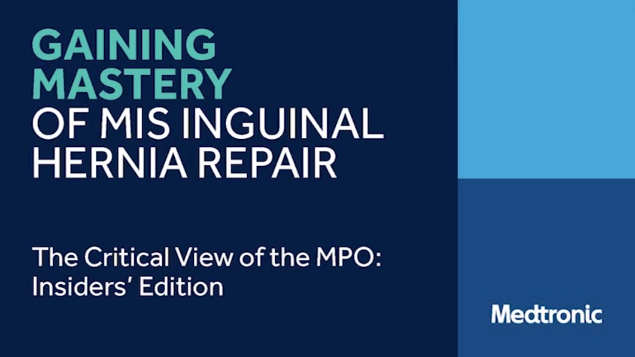 Webinar Part 3 | The Critical View of the MPO: Insider's Edition - YouTube