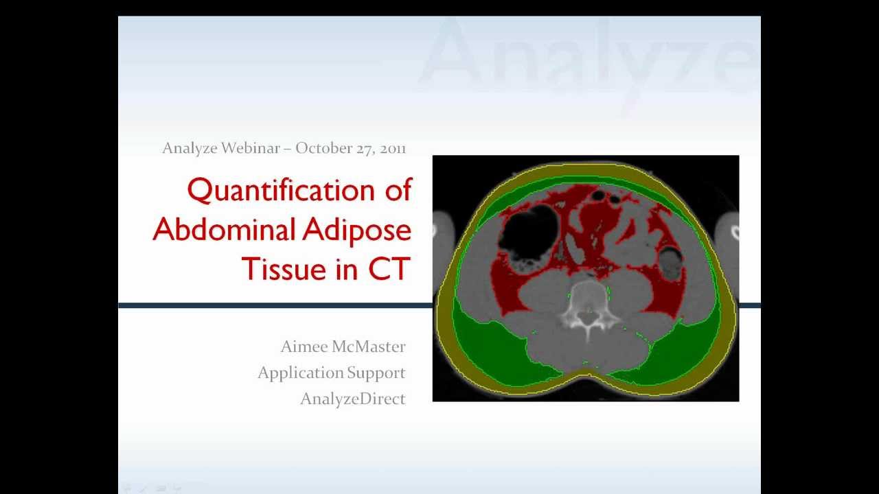 Quantification of Abdominal Adipose Tissue from CT using Analyze 10.0 ...