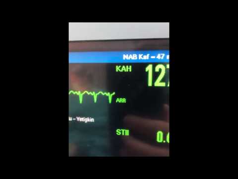 Kalp atım sesi gerçek sesler - heart beat