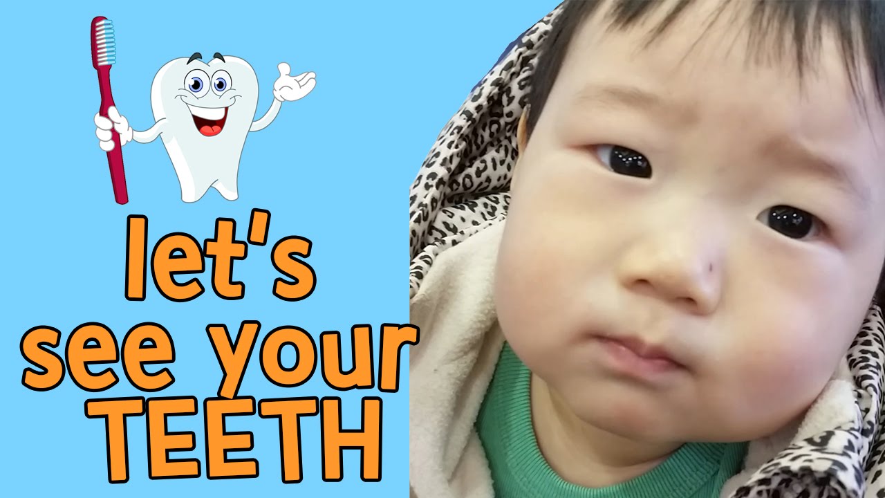 Let's see your teeth! 이좀 보자! - YouTube
