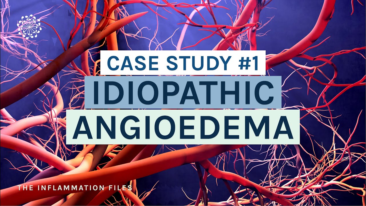 Idiopathic Angioedema - Case Study #1: The Inflammation Files with Dr ...