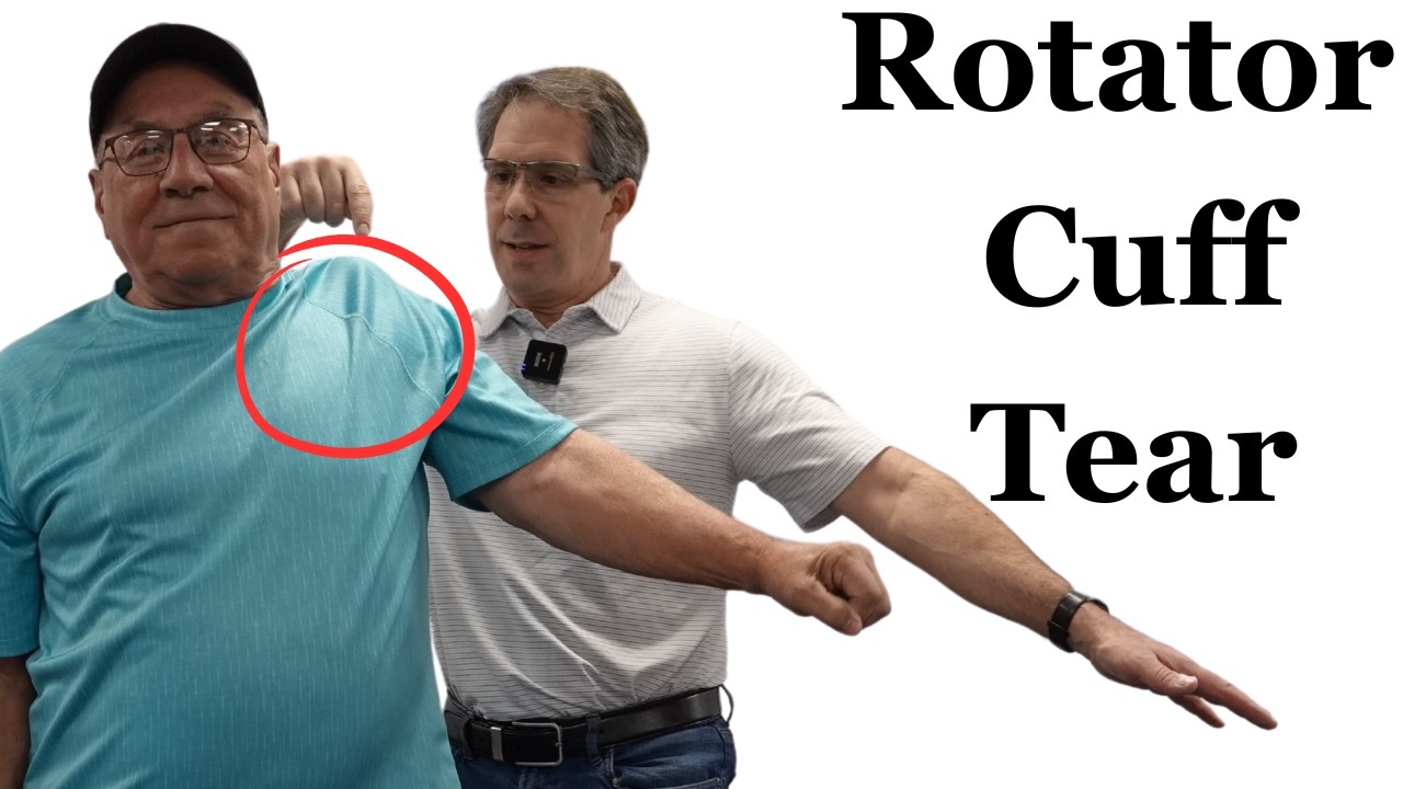 Most Common Signs of a Massive Rotator Cuff Tear (PT Exam) - YouTube