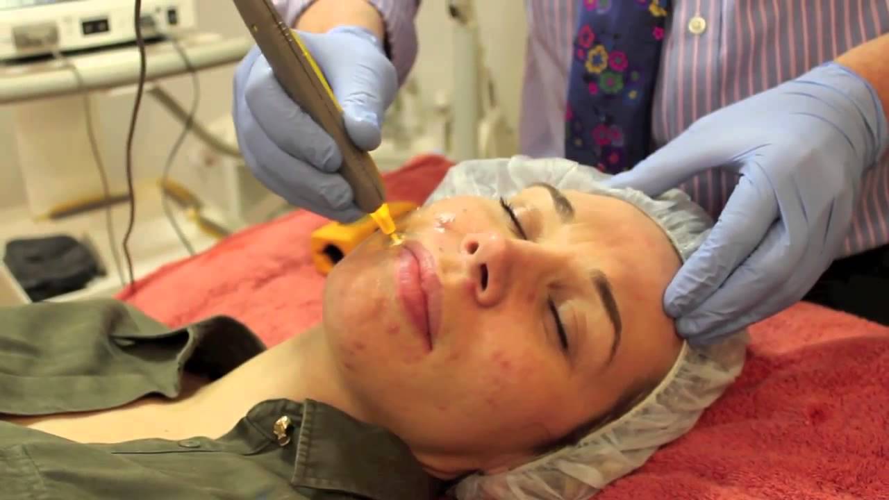 Pellevé Stratford upon Avon Dermatherapy Clinic - YouTube