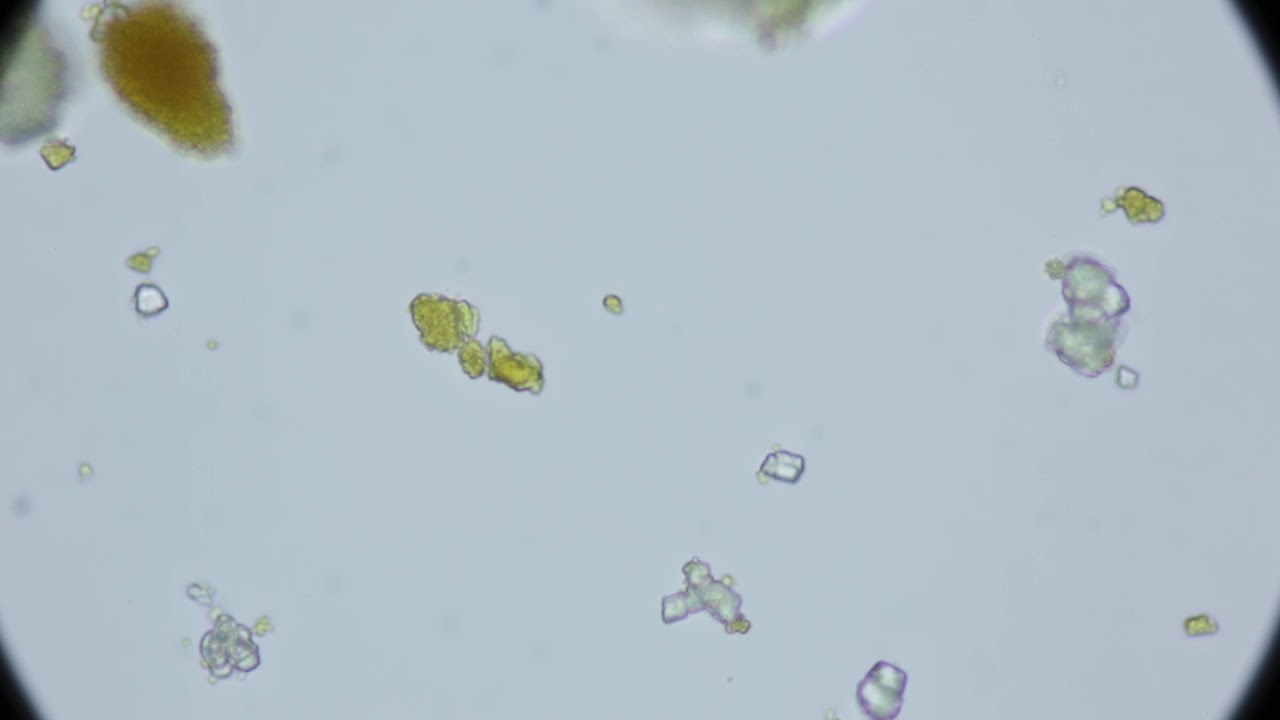 Antarctic Bacteria (200x) from Blood Falls #5 - YouTube