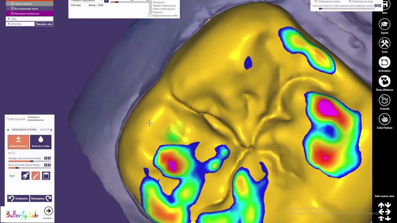 Exocad Wiki File:RegistrazioneModelliExocadIta.jpg - exocad
