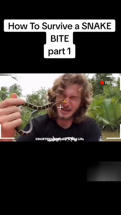 How to survive Snake Bite Part-01 | #snakebites #lessons #safeourlive # ...