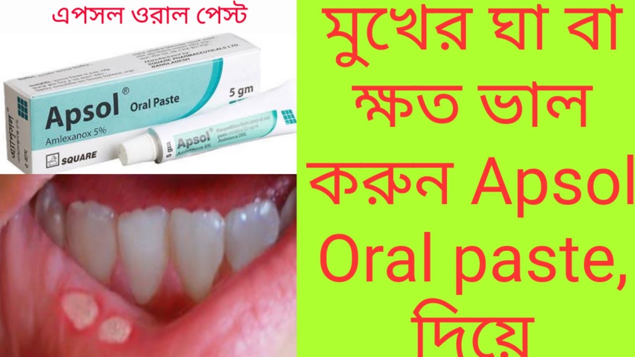 মুখের ঘা বা ক্ষত দুর করুন" Apsol Oral Paste" দিয়ে - YouTube