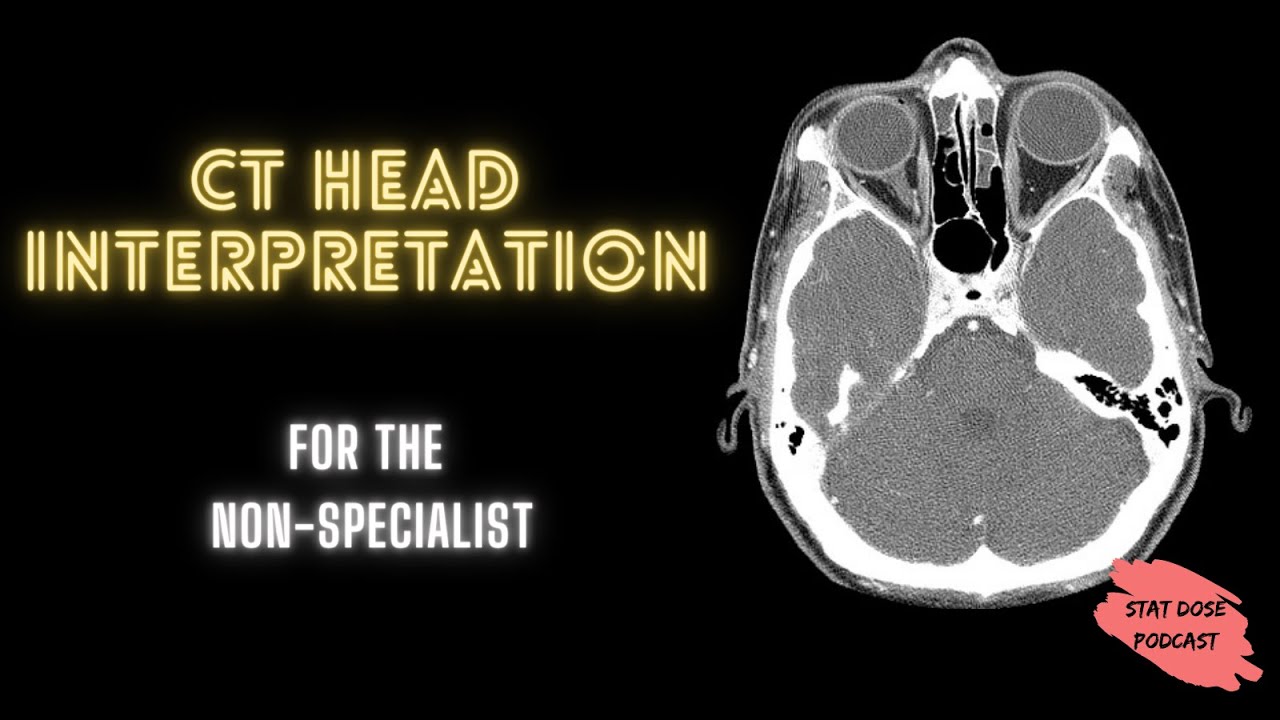 CT Head Interpretation - YouTube