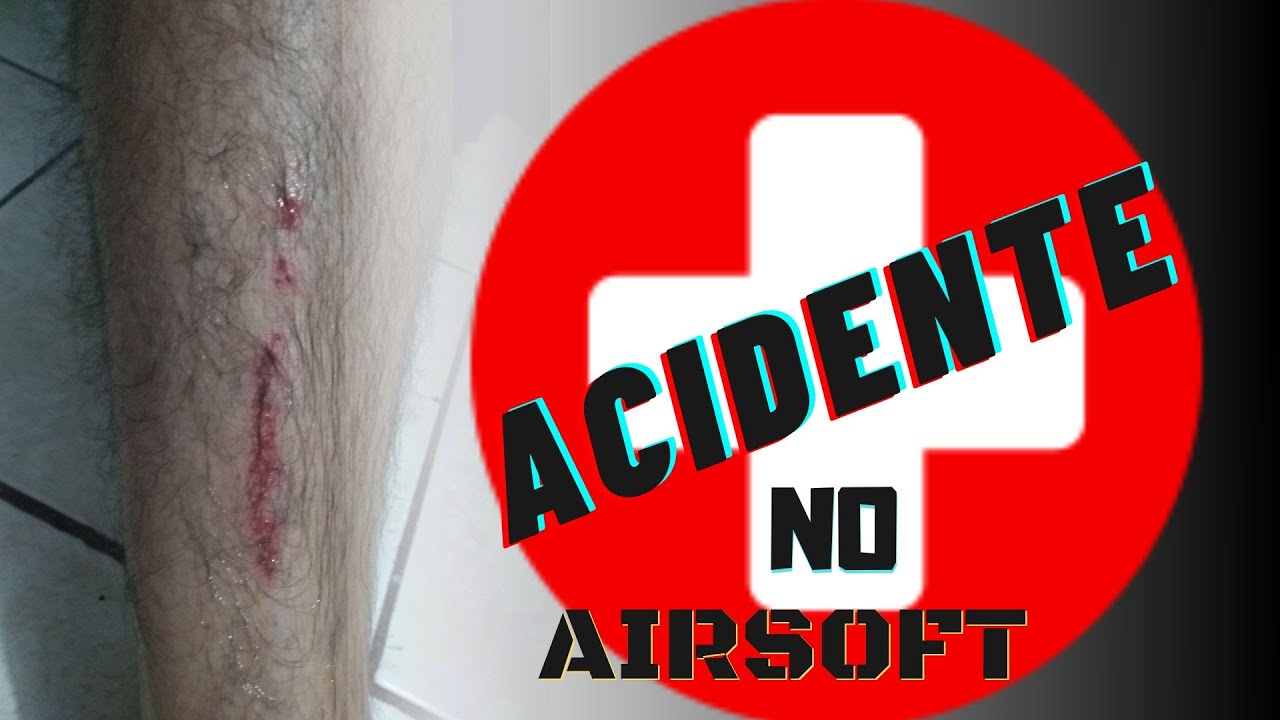 ACIDENTE no Airsoft - como se proteger - YouTube