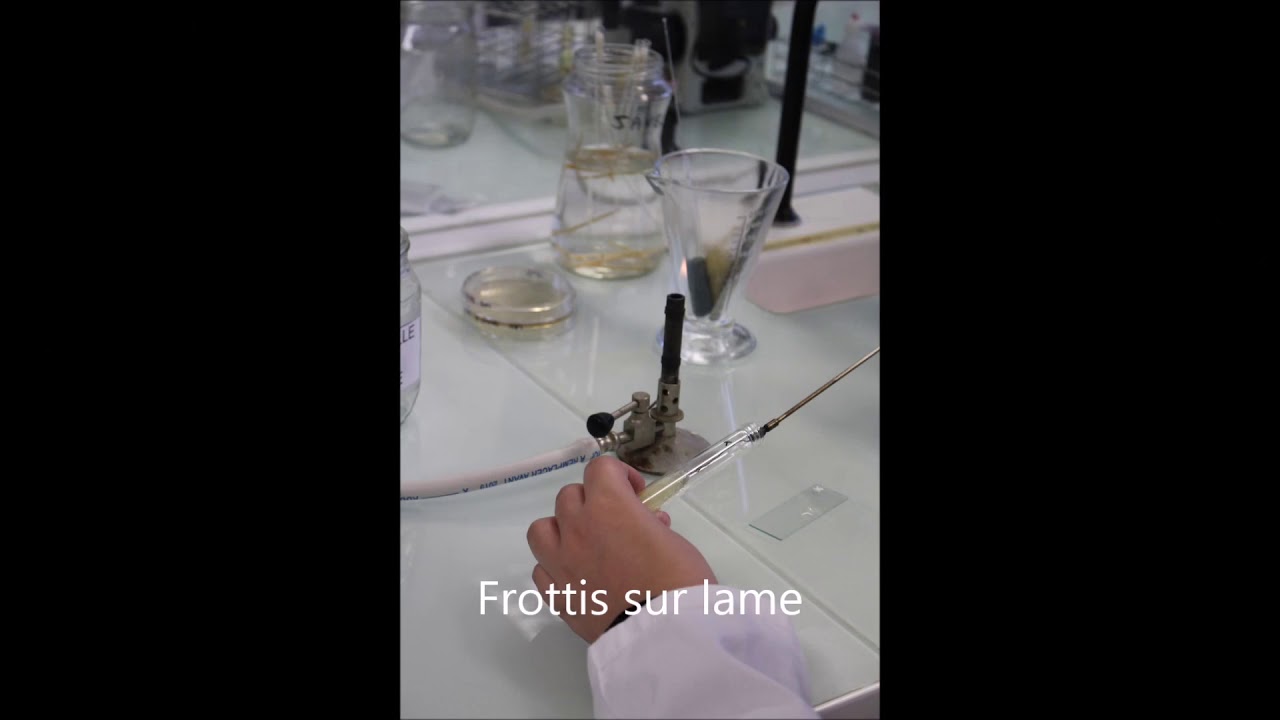 La Microbiologie en BTS ABM - YouTube