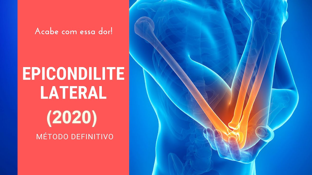 Acabe Definitivamente com a Epicondilite Lateral (2020)! - YouTube