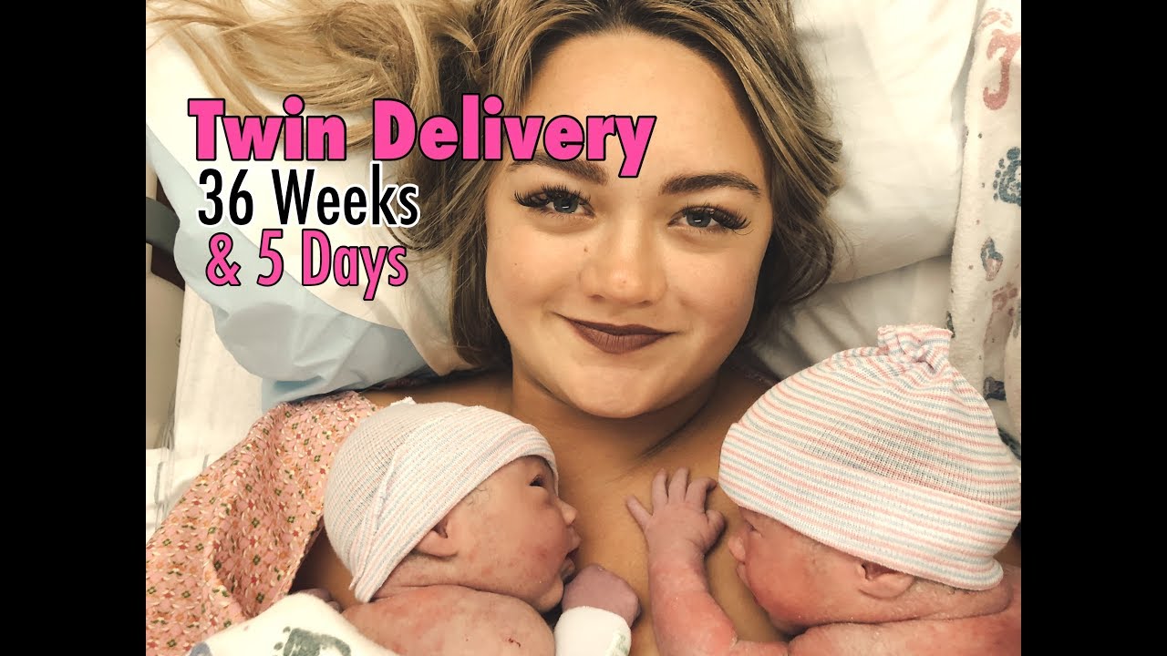 Twin Delivery At 37 Weeks