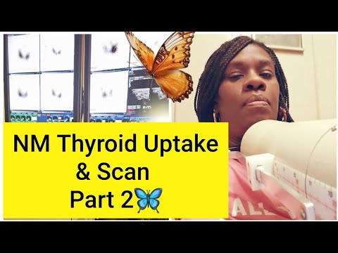 NM Thyroid Uptake & Scan |Hyperthyroidism |Part 2 🦋 - YouTube