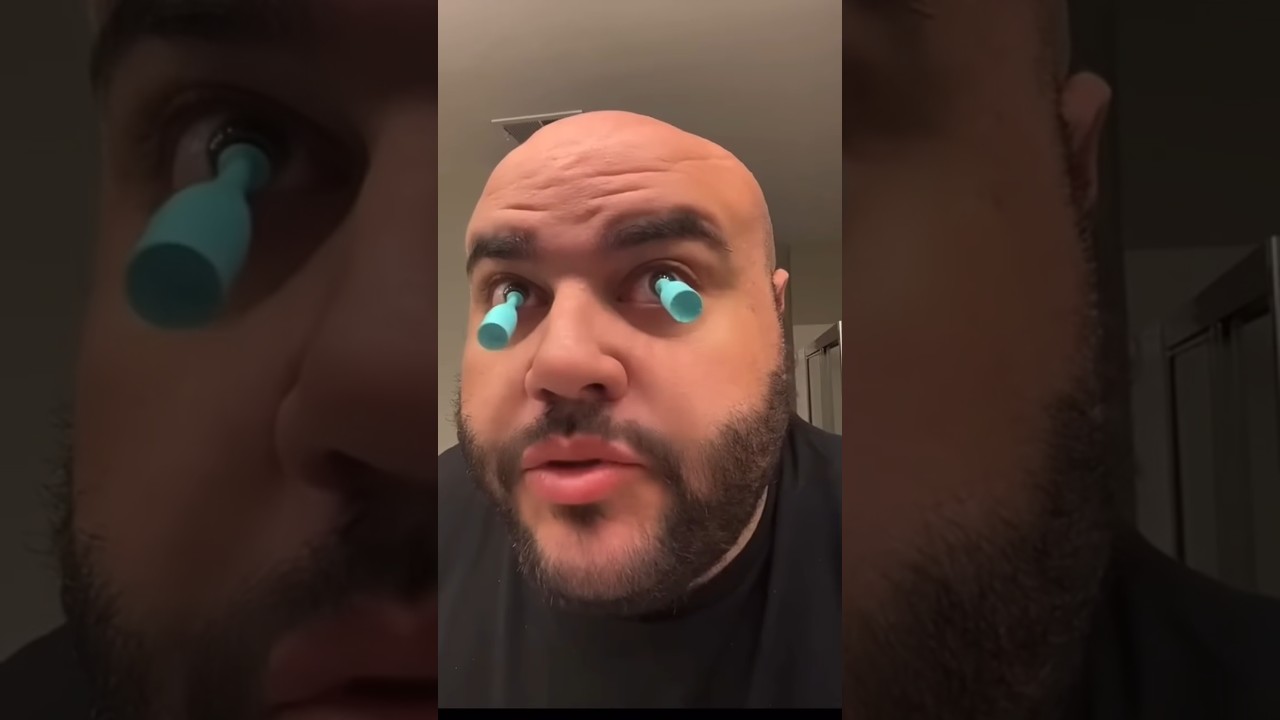 MY EYEBALL CAME OUT😳😳 #comedy #funny - YouTube