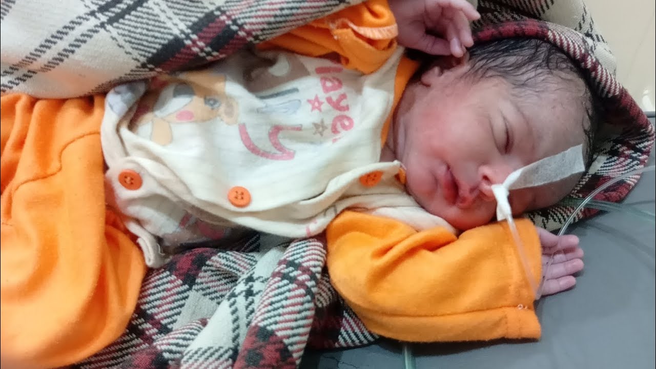 After birth baby synozed symptoms poor cry,his mom sad🥺 news #youtube # ...