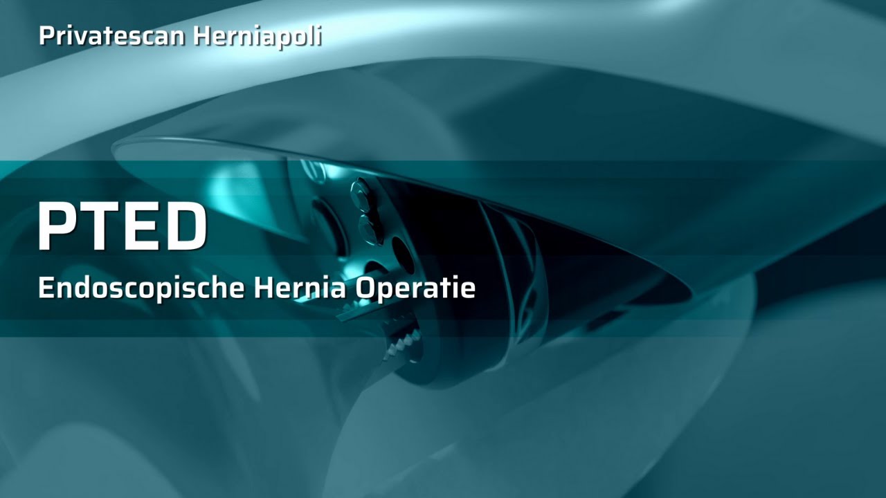 Animatie: PTED hernia operatie - Herniapoli - YouTube