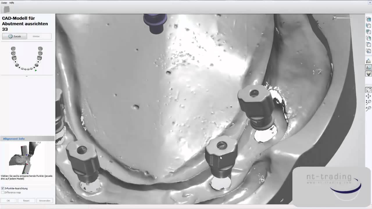 DIM (Digital Implant Model) Analogue nt-trading - YouTube