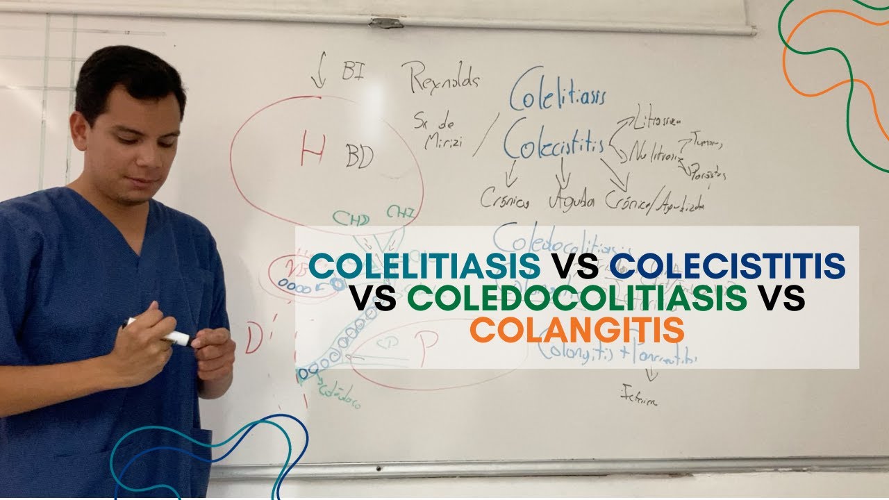 Colelitiasis vs Colecistitis vs Coledocolitiasis vs Colangitis - YouTube
