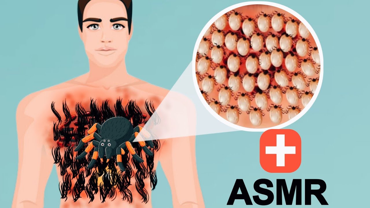 ASMR Removes chest hair And treatment | stop motion 2D Animation ...