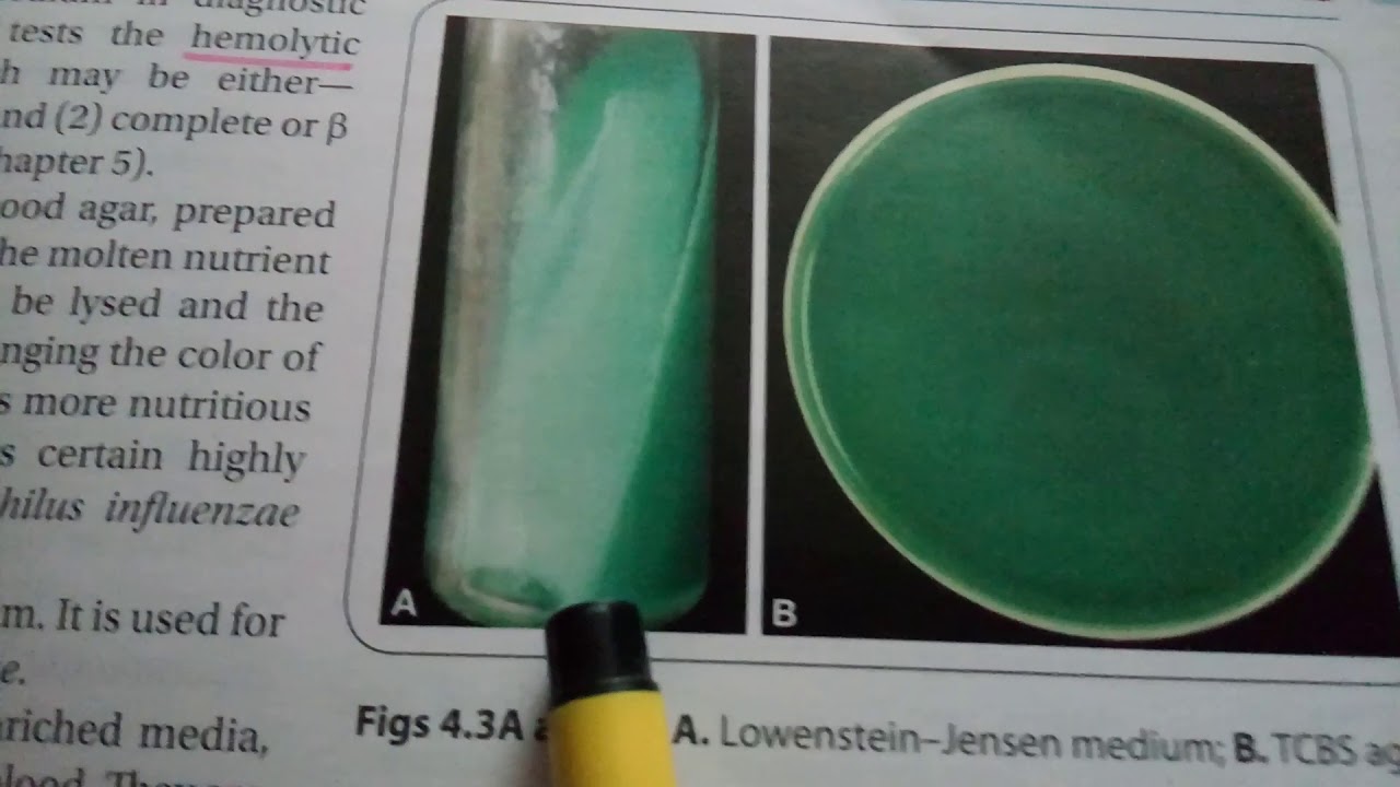 Culture Media 5. Enrichment broth vs Selective. - YouTube