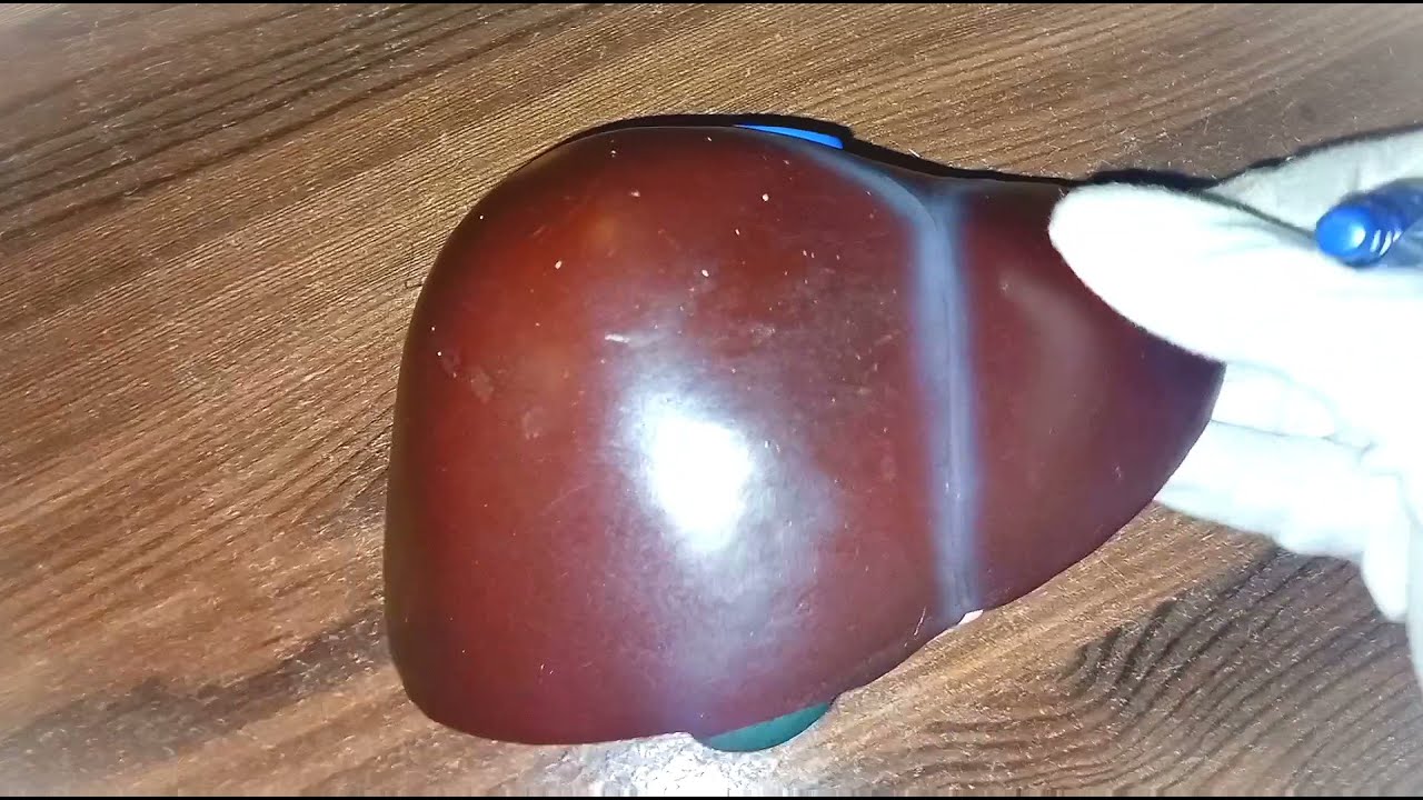 Spotting Of Liver Model ; Superficial Anatomy Of Model Of Liver For ...