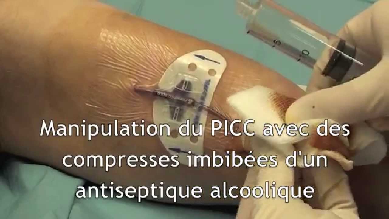 pansement picc chd vendee - YouTube