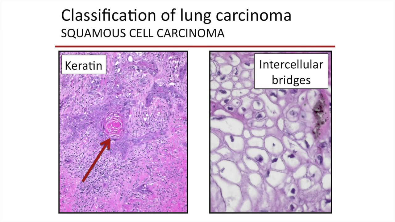 Intercellular Bridges