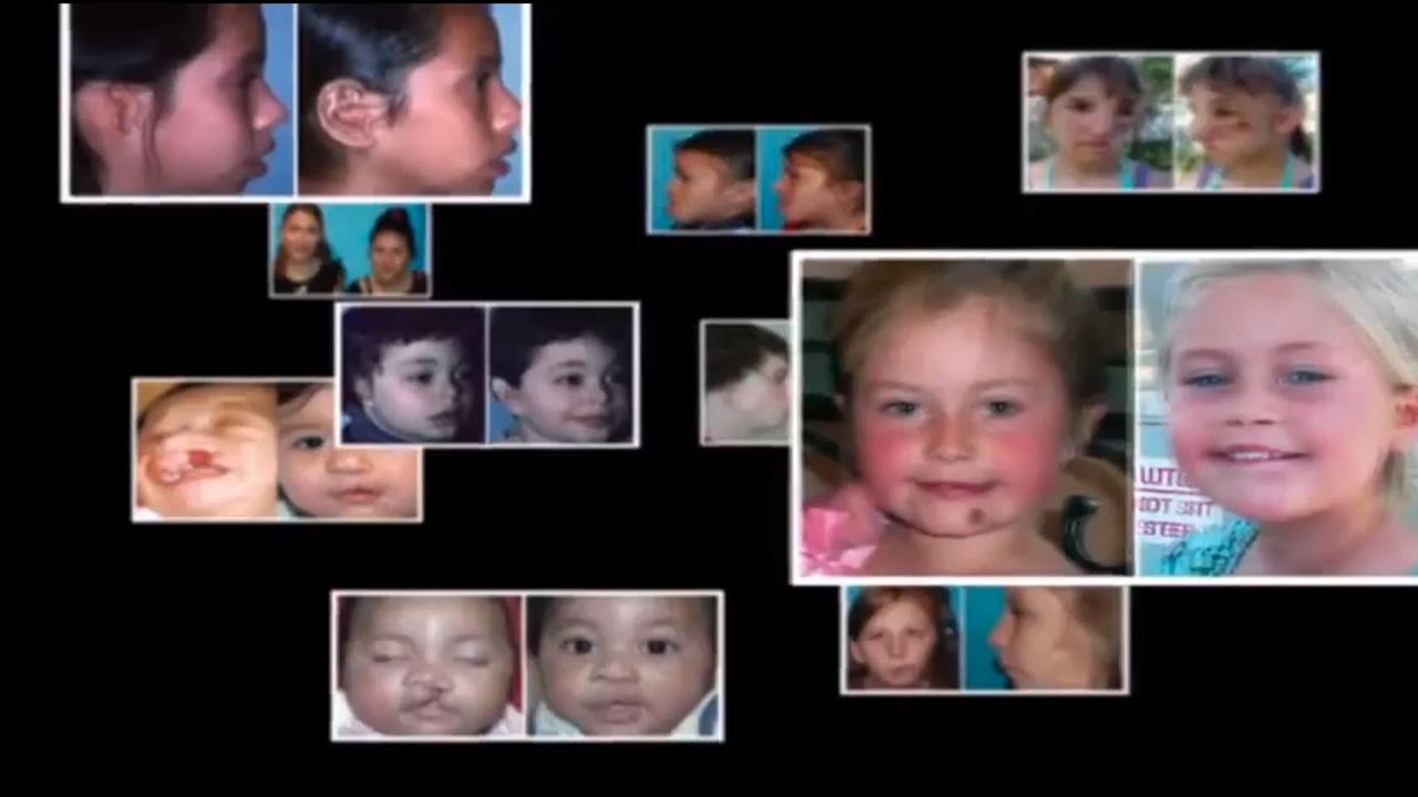 Transforming Lives & Faces of Children - YouTube