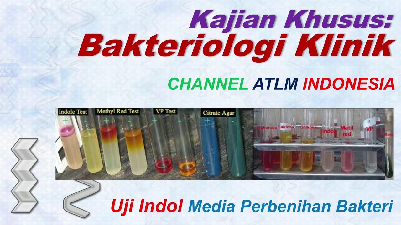 Uji Indol Perbenihan Bakteri (Edukasi ATLM Analis Kesehatan ...