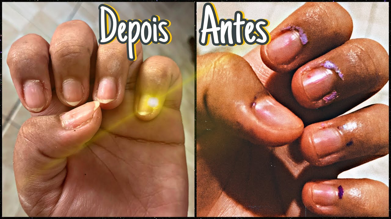 Como para de roer unha + meus esmaltes - YouTube