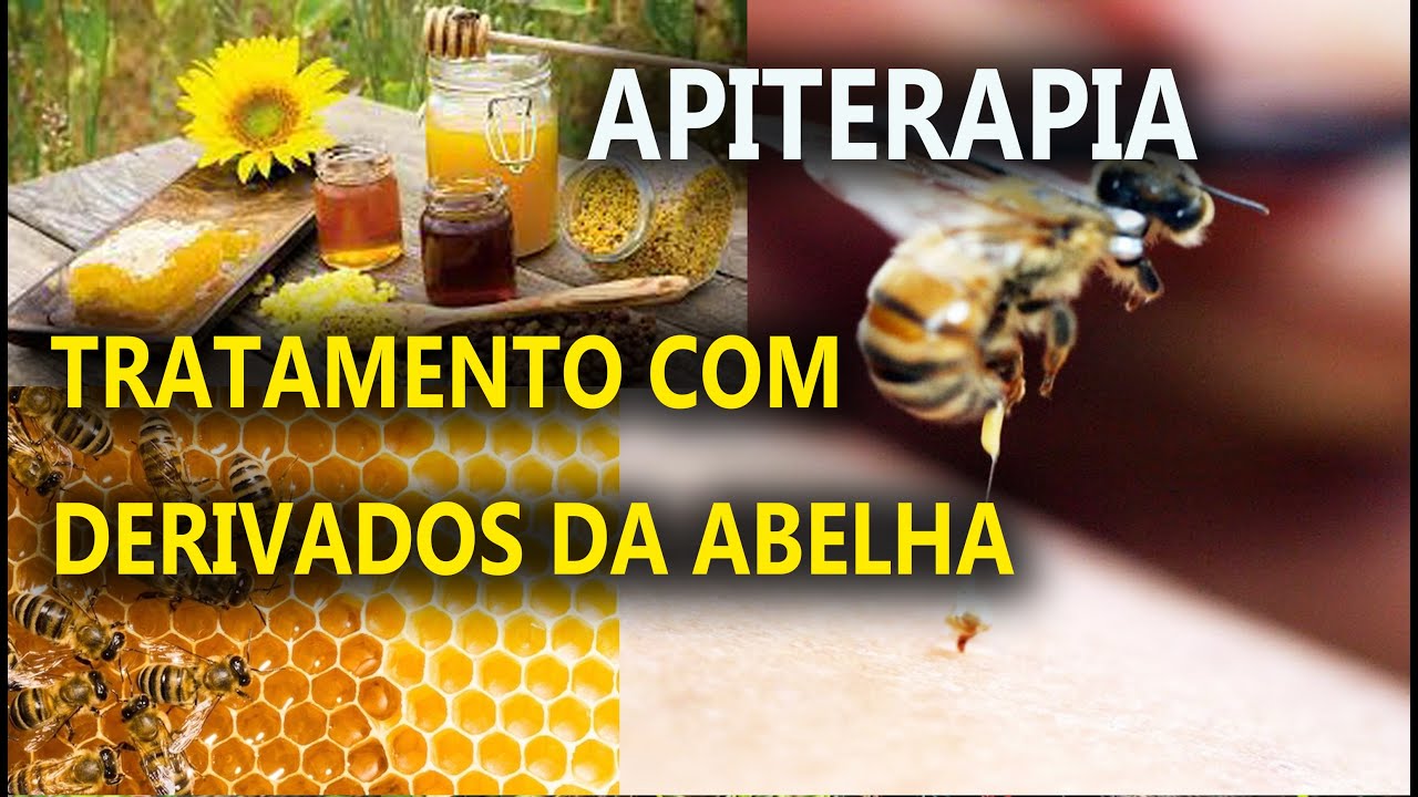 Apiterapia, Terapia a Base de Derivados das Abelhas - YouTube