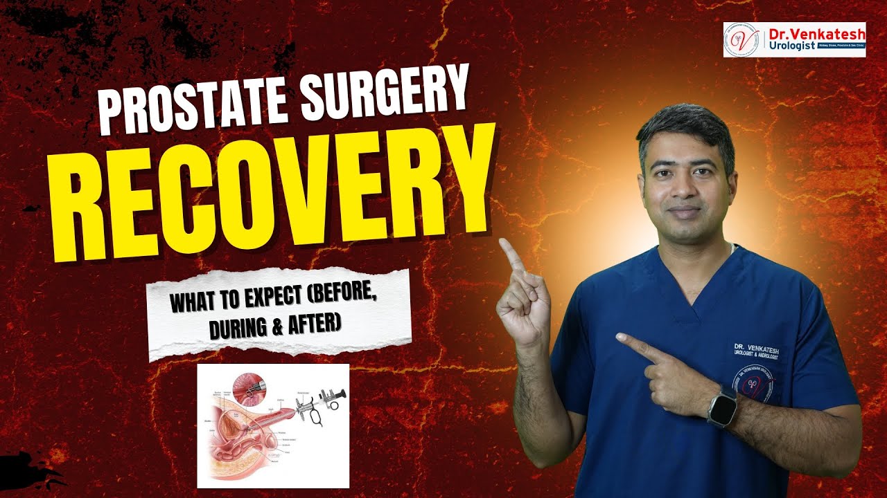 Prostate Surgery Recovery: What to Expect (Before, During & After ...