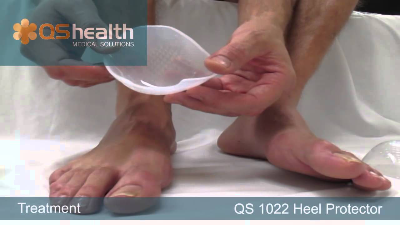 QS HEALTH Heel Cups - YouTube