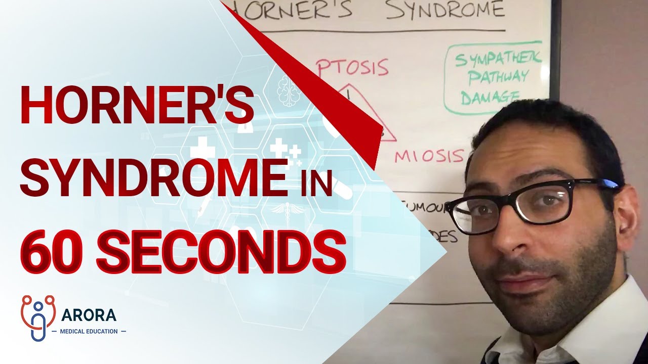 Horner's Syndrome in 60 seconds - YouTube