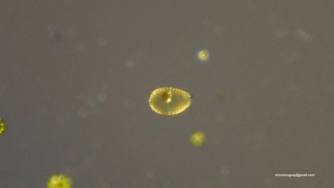 Ciliado Coleps visto al microscopio luz polarizada - Ciliate Coleps ...