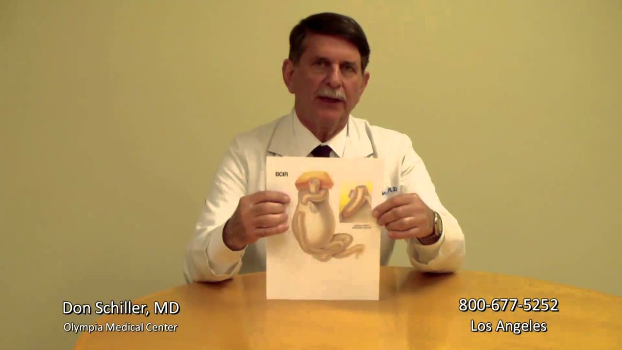 The BCIR alternative - Creating a reservoir from the patient's own ...