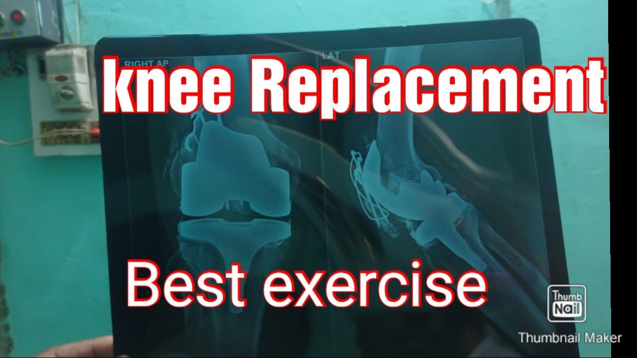 knee Replacement best exercise, knee mobilization best exercise, knee ...