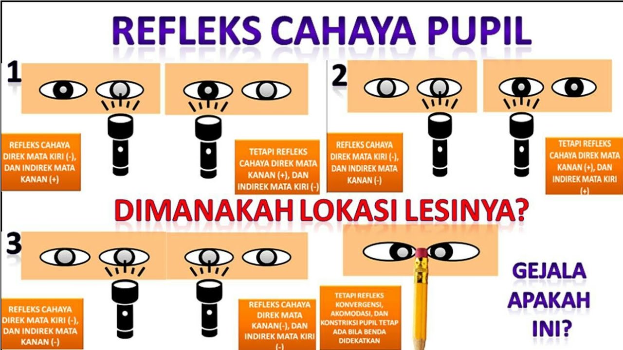 Video 33 Refleks Cahaya Pupil - YouTube