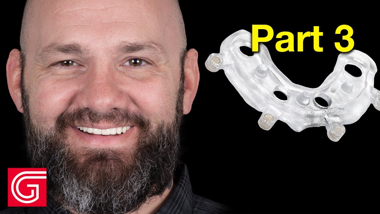 HOW TO Place an Implant Prosthesis Using a Surgical Guide - YouTube