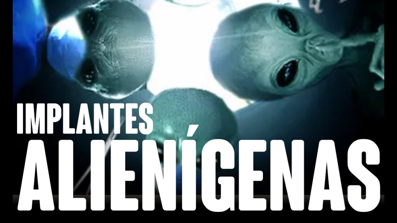 Implantes alienígenas - Parte II - RADIO CAST 15 8 23 - YouTube
