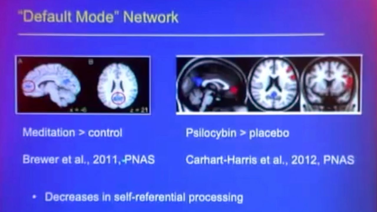 Roland Griffiths Compares Psilocybin and Meditation fMRI - YouTube