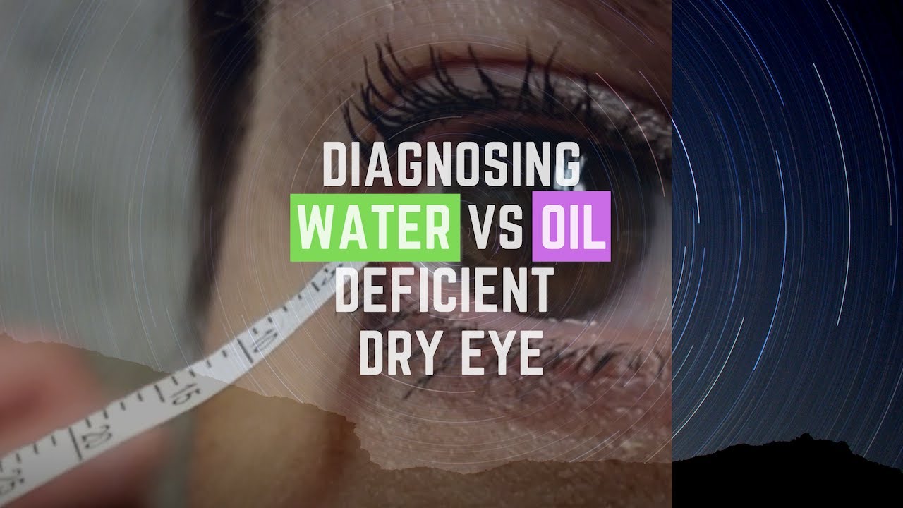 Diagnosing Oil vs Water Deficient Dry Eye Using Zone-Quick Test - YouTube