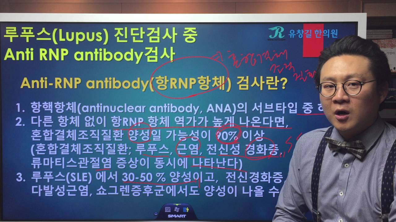 루푸스(Lupus) 진단검사 중 항RNP항체(Anti-RNP antibody) 검사 - YouTube