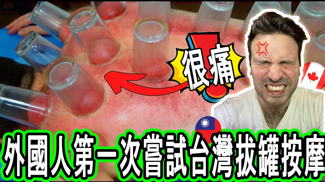 I Tried Taiwan's PAINFUL Cupping Therapy So You Don't Have To - How Bad ...